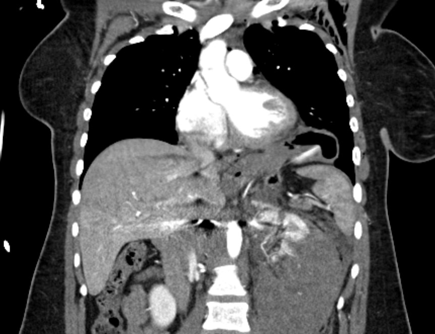 Case Quiz: 31-Year-Old With Multiple Car Crash Injuries - ARRS InPractice